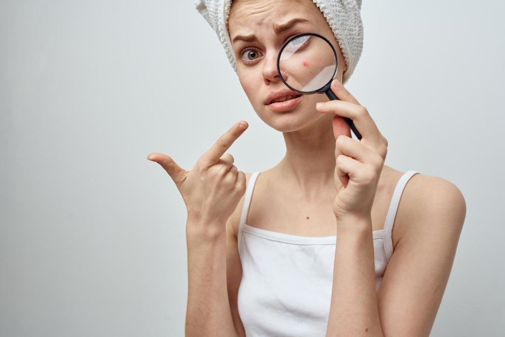 Why Do Sunscreens Break Me Out? Understanding the Causes!